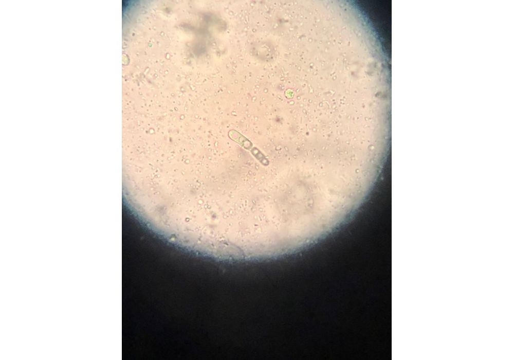 下痢と Cyniclomyces guttulatus/ 領下動物病院