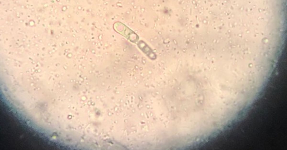 下痢と Cyniclomyces guttulatus/ 領下動物病院